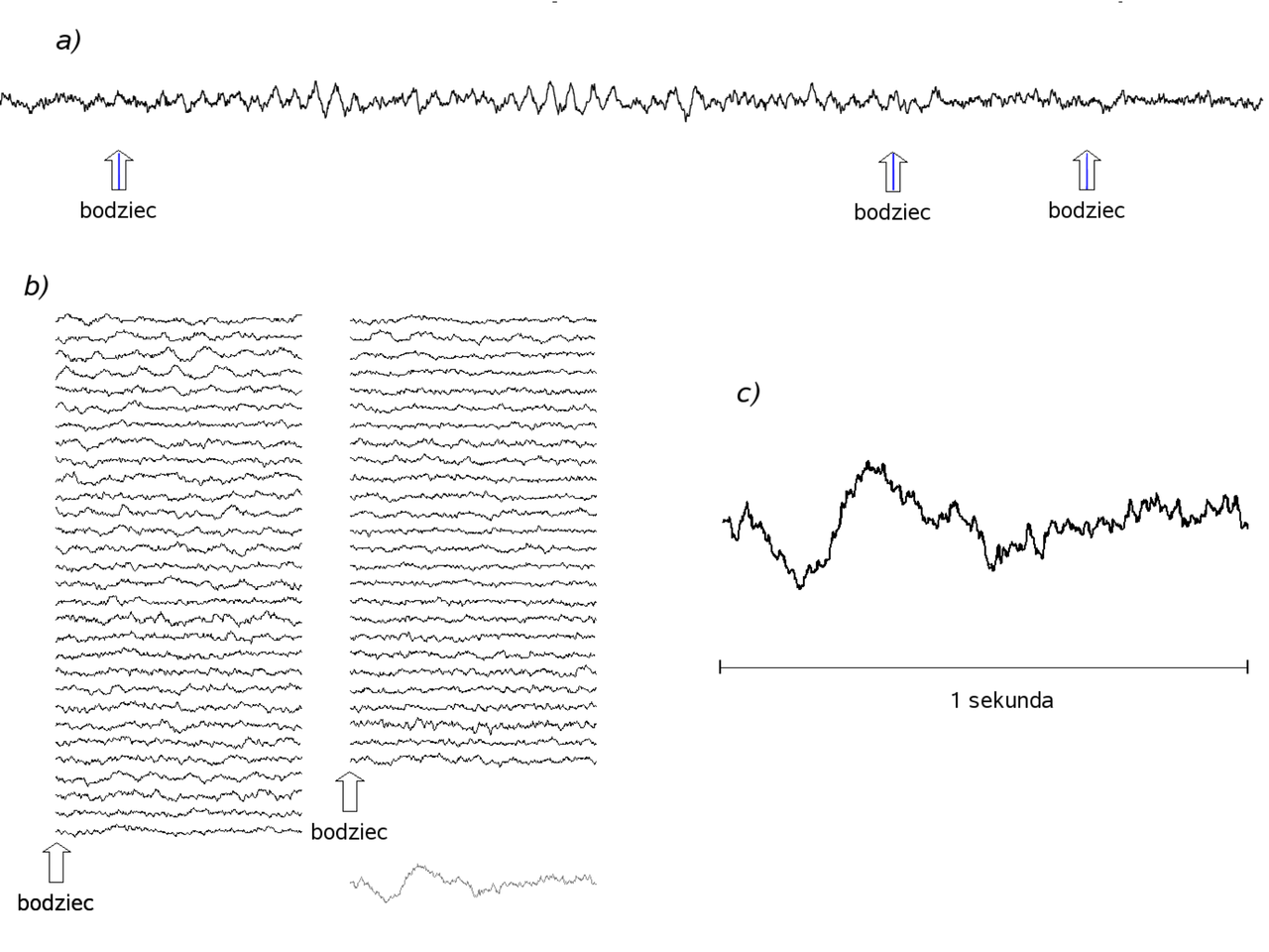 Pracownia EEG/Potencjały wywołane – Brain-wiki
