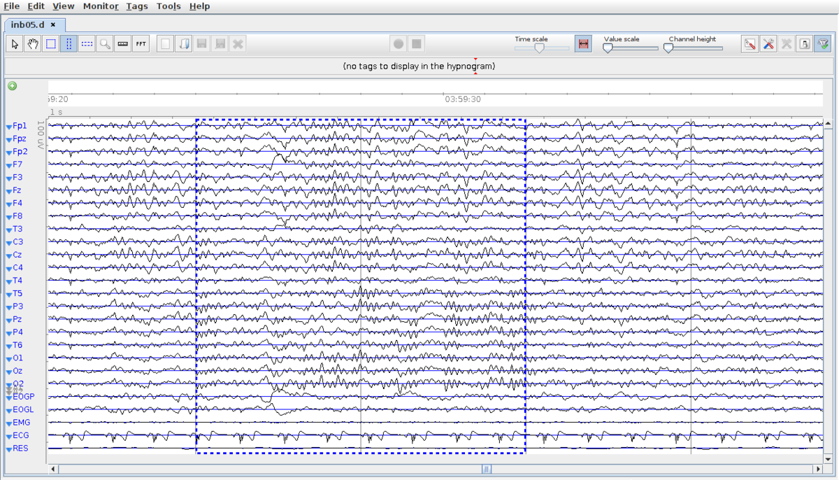 Pracownia EEG/EEG spoczynkowe – Brain-wiki